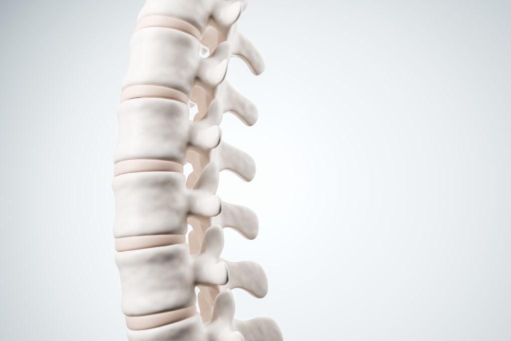 Slipped Discs In The Neck, Disc Herniations. Chiropractic Treatment